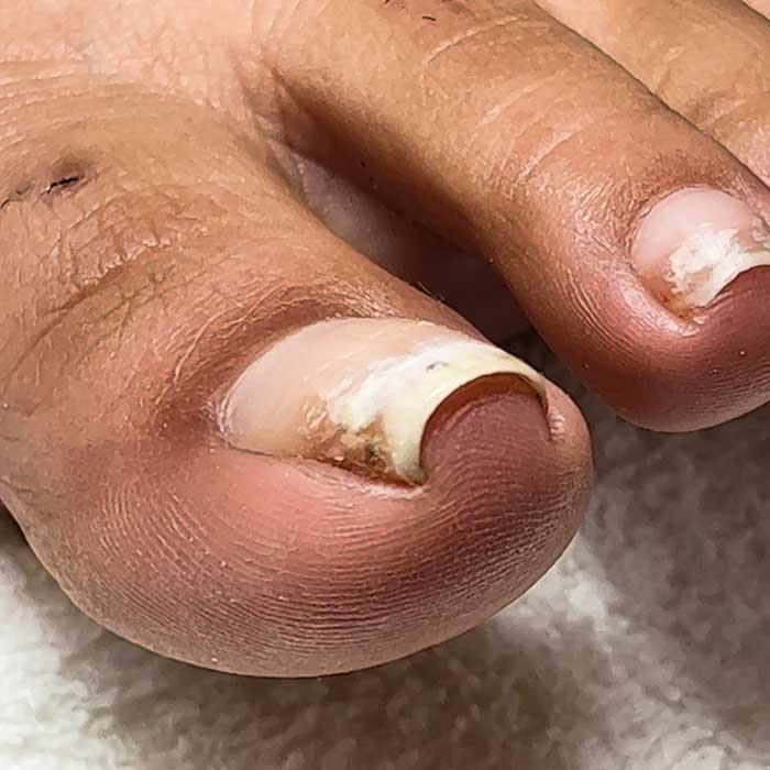 Restore-A-Nail – Meticulous Manicurist Beauty Supply