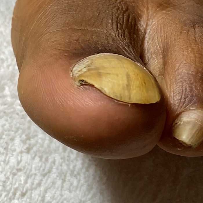 Restore-A-Nail – Meticulous Manicurist Beauty Supply